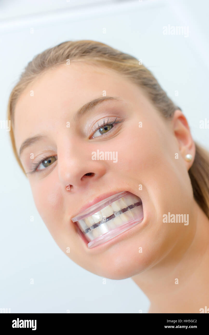 Woman mouth open check hi-res stock photography and images - Alamy