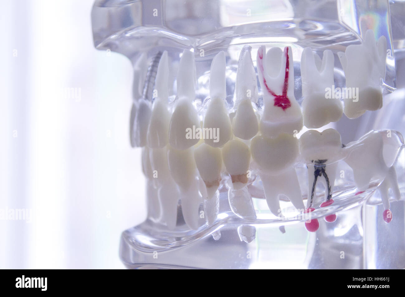 False teeth sample for dentists Stock Photo - Alamy