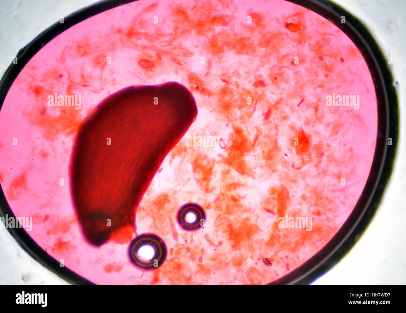 The Microscopic World. Drop of jam under the microscope Stock Photo - Alamy