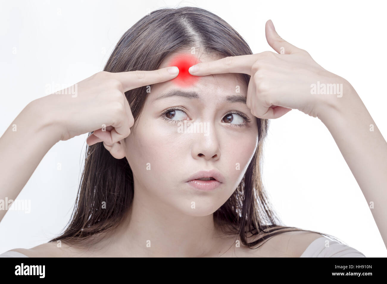 Spot forehead hi-res stock photography and images - Alamy