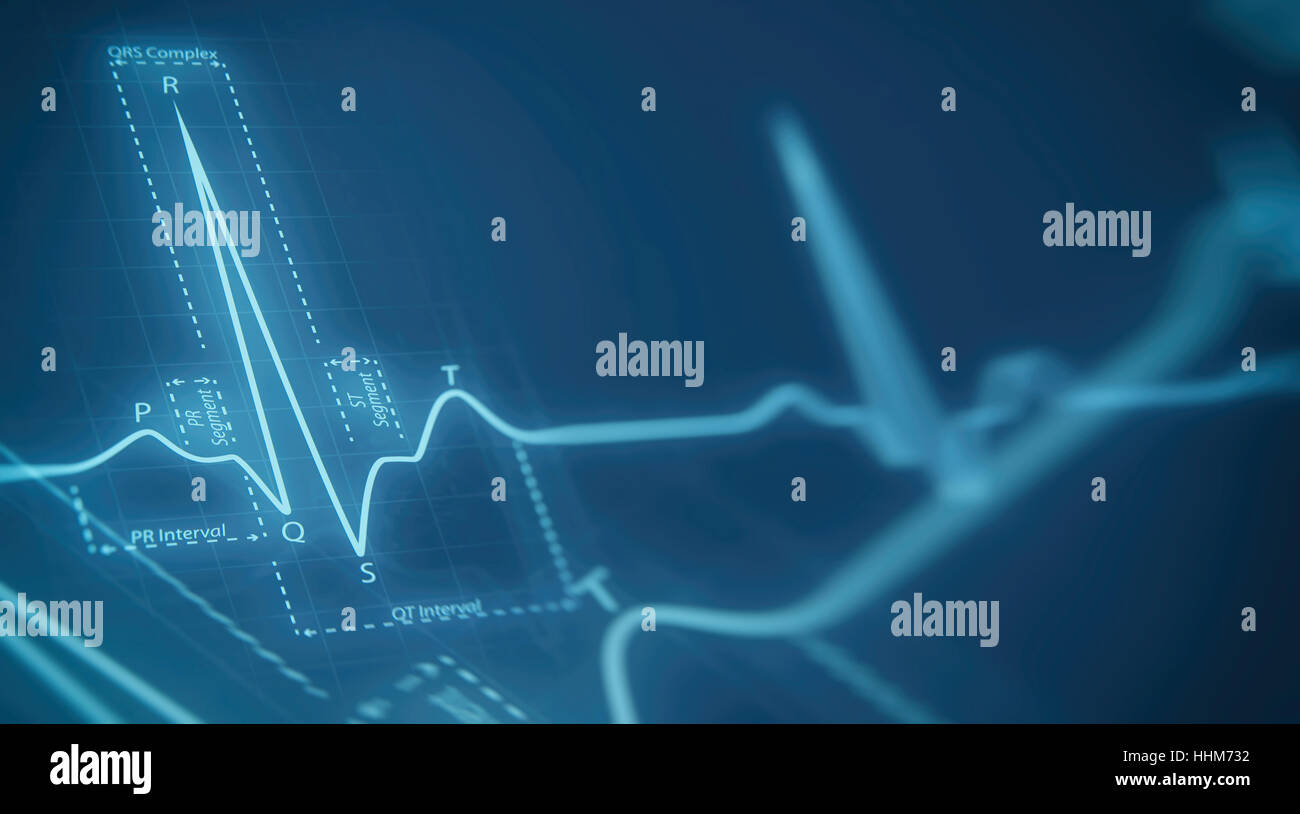 Ekg normal hi-res stock photography and images - Alamy
