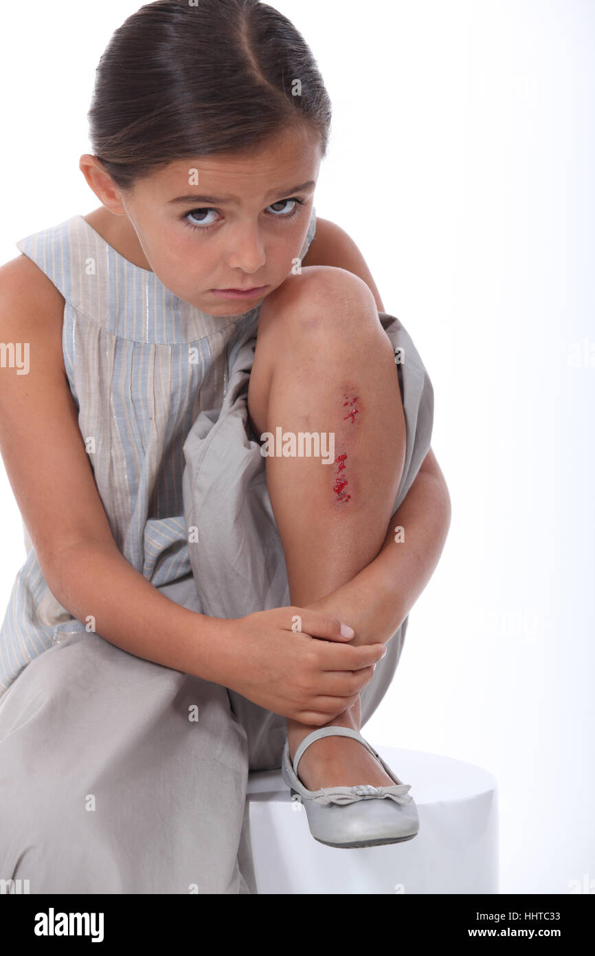 small, tiny, little, short, injury, scrape, childhood, minor, young ...