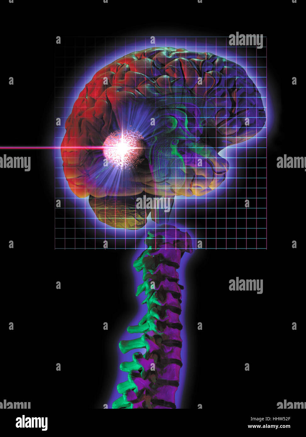 medicinally, medical, science, radiation, diagram, brain, spine ...