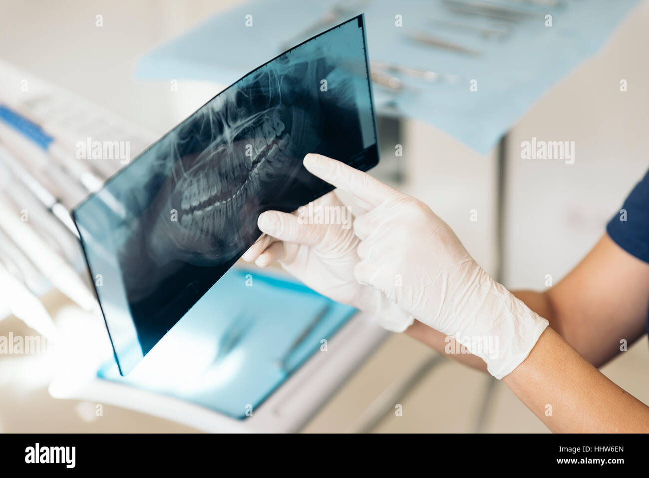 Doctor talking with her patient and teaching a radiograph. Medical ...