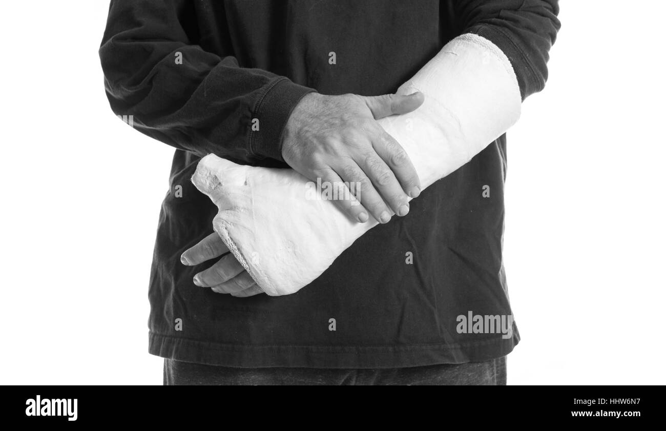 Thumb spica cast hi-res stock photography and images - Alamy