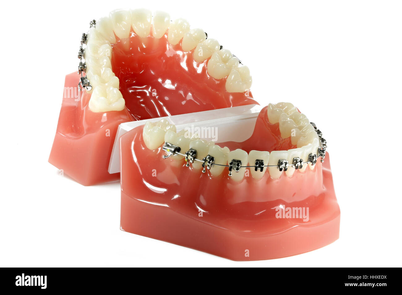 Braces teeth Cut Out Stock Images & Pictures - Alamy
