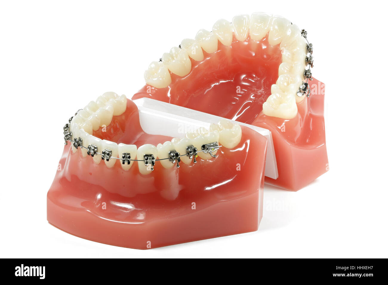 tooth model with metal wired dental braces isolated on white background ...