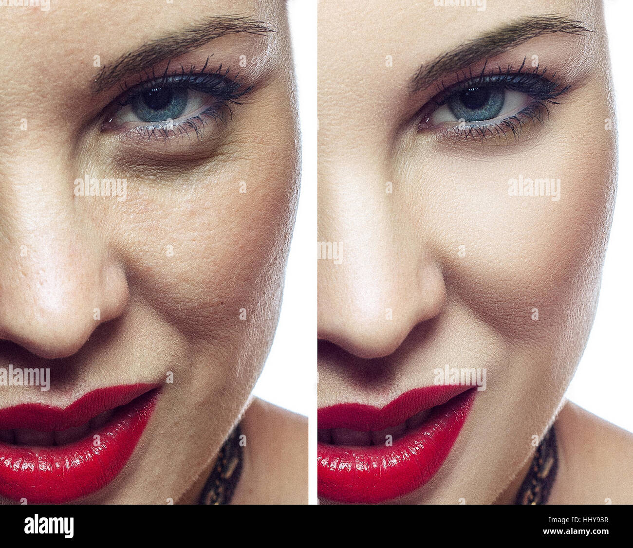 Woman face before and after cosmetic procedure. Facial cosmetology ...