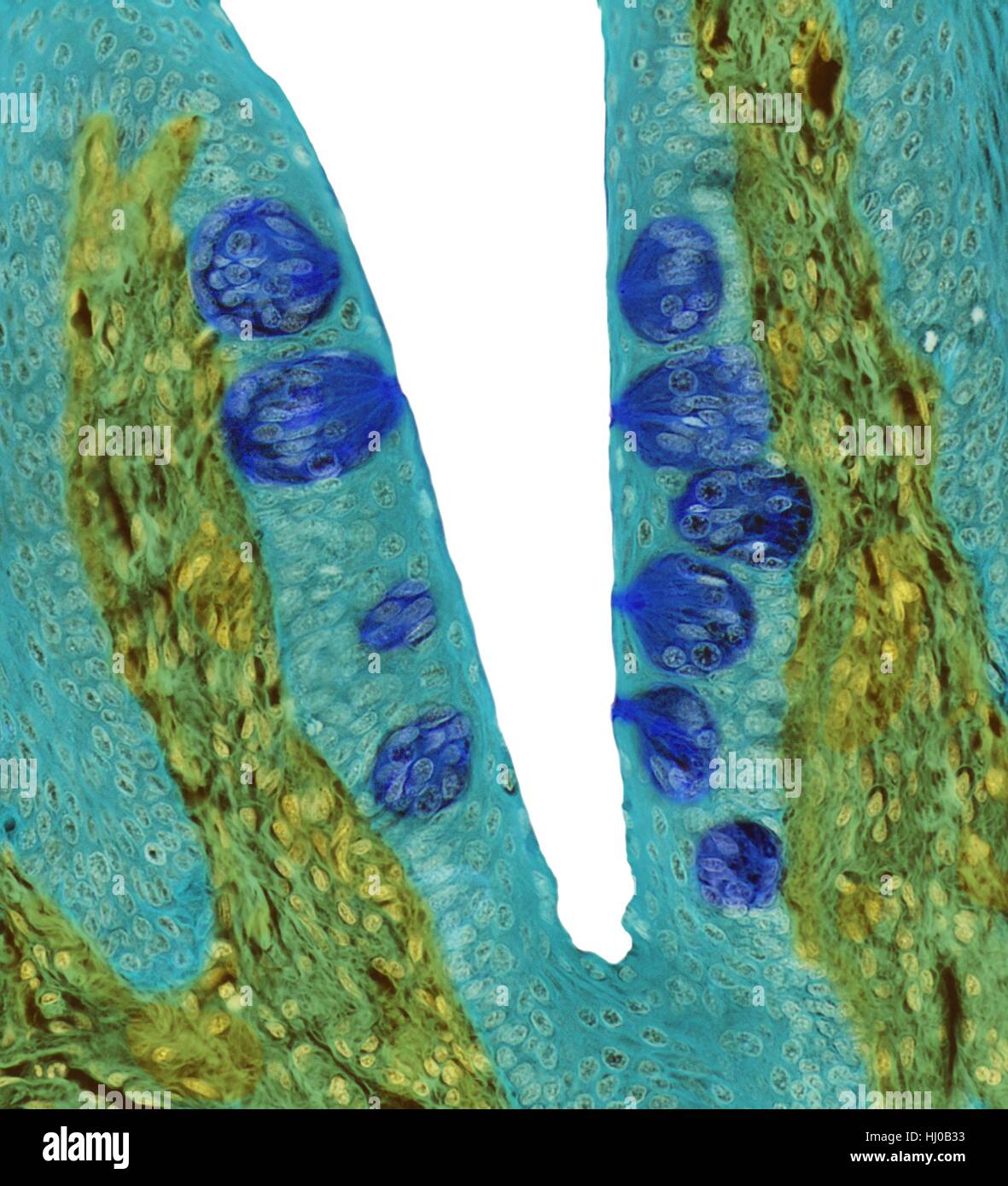 Taste buds.Coloured light micrograph of section through tongue,showing ...