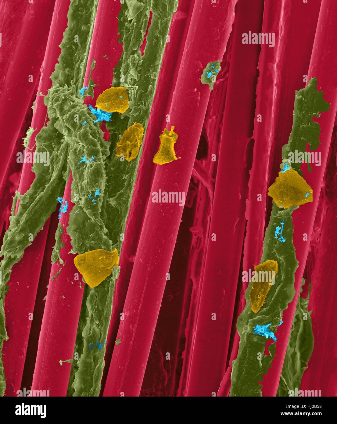 Dental plaque micrograph hi-res stock photography and images - Alamy