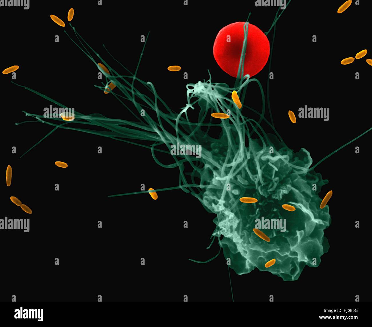 Macrophage Pleural Fluid