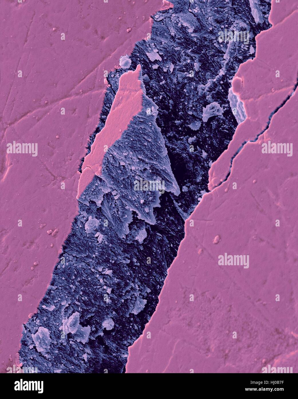 Human tooth fractured enamel,coloured scanning electron micrograph (SEM ...