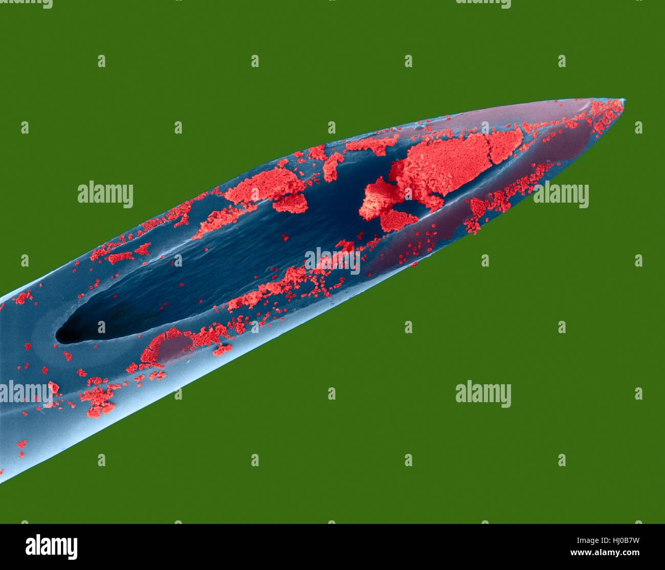 Hypodermic needle (26 gauge) human blood,coloured scanning electron ...