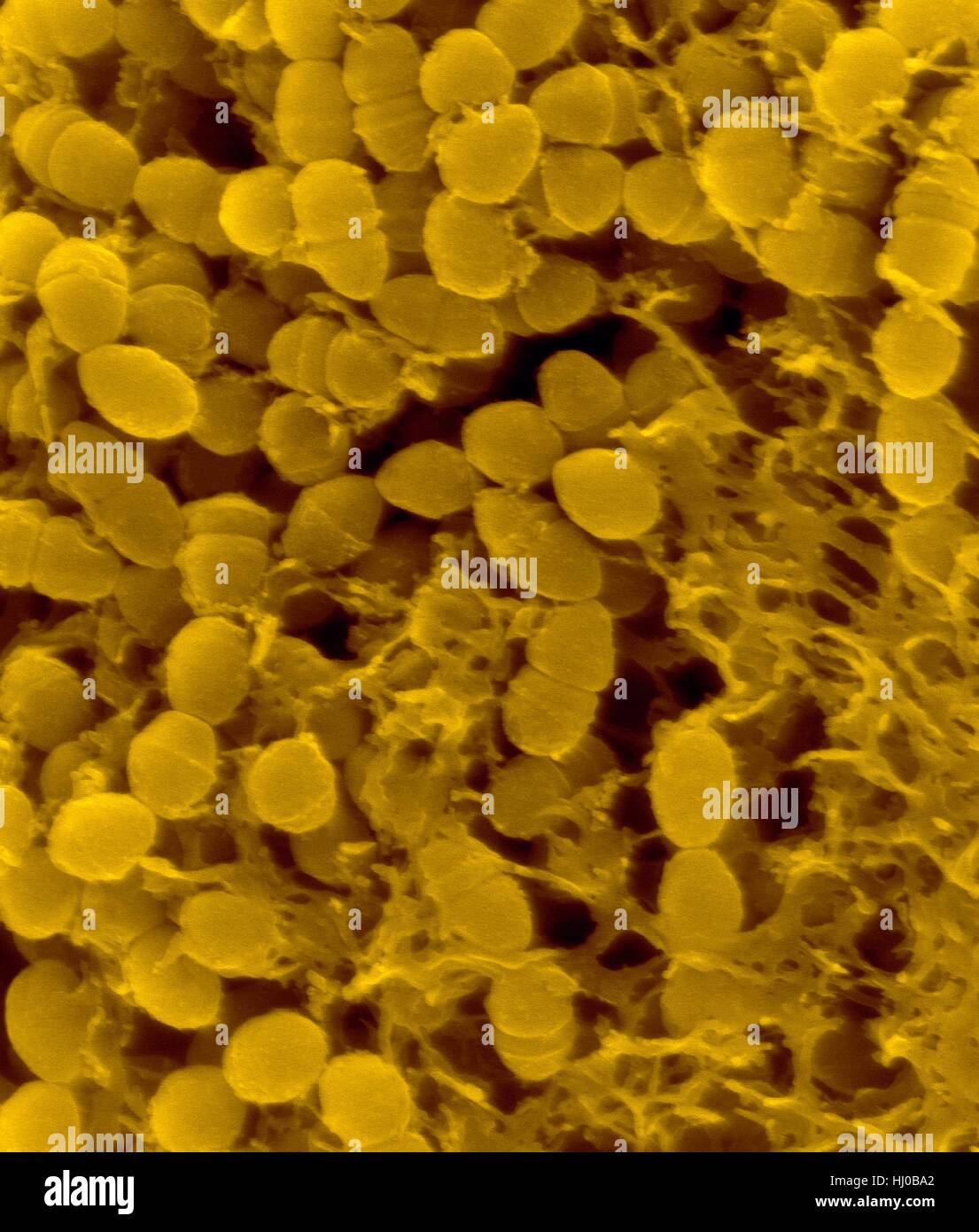 Streptococcus mutans bacteria hi-res stock photography and images - Alamy
