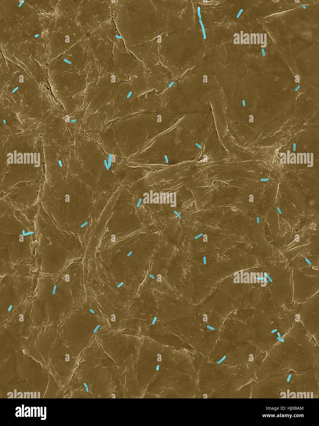 Escherichia coli electron micrograph hi-res stock photography and ...