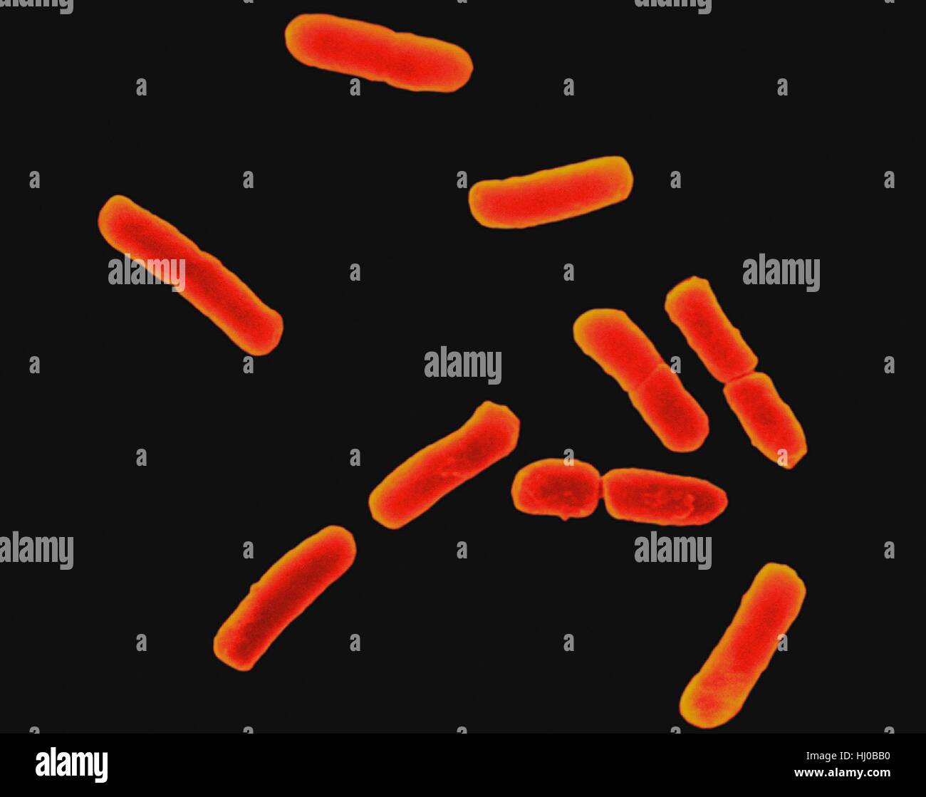 Coloured scanning electron micrograph (SEM) of Escherichia coli is a ...