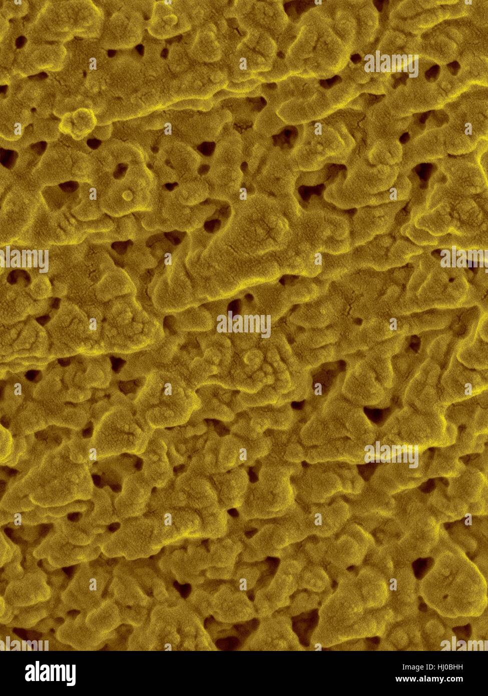 Coloured scanning electron micrograph (SEM) Emu eggshell surface tiny ...