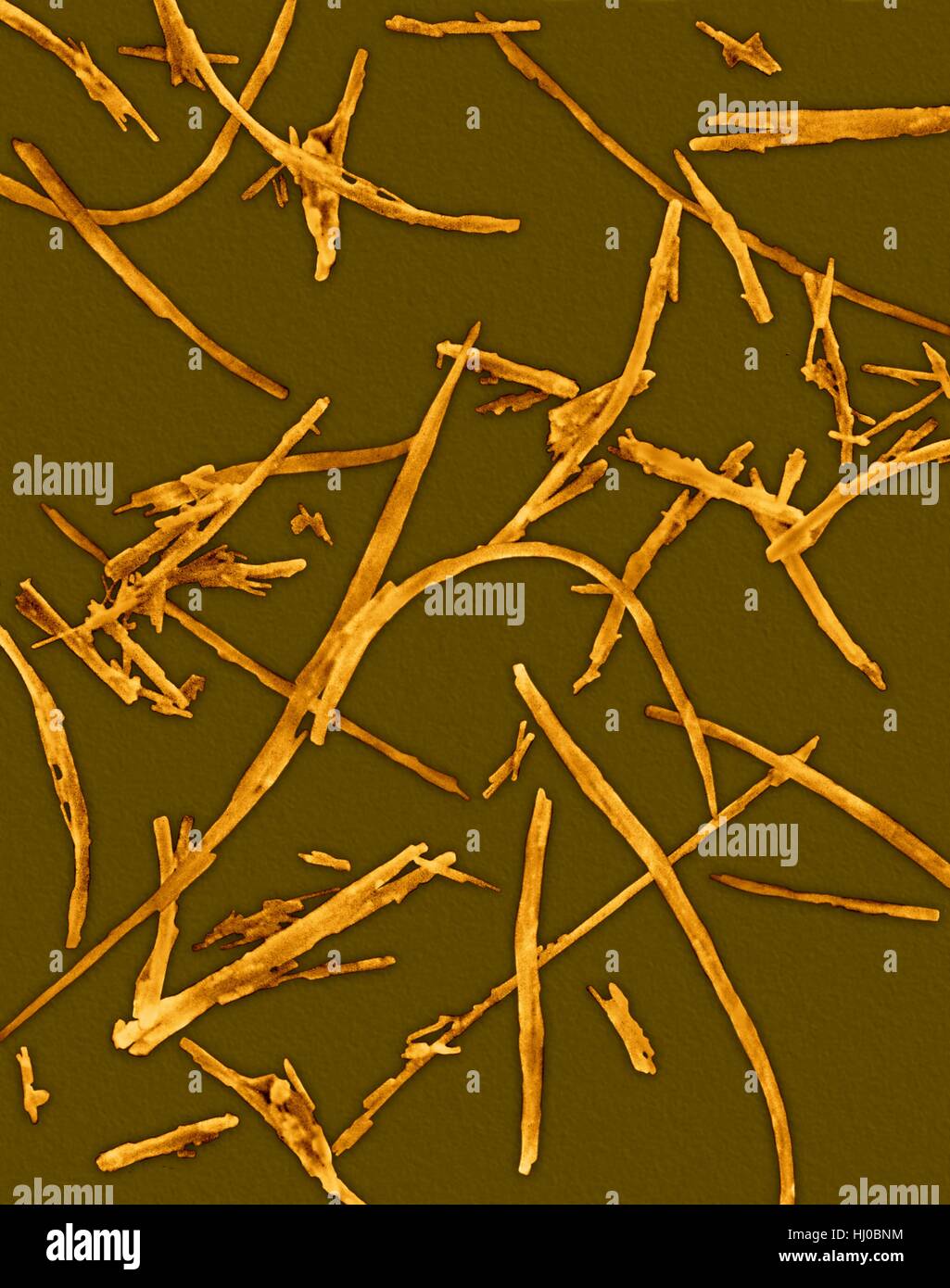 Asbestos insulation hi-res stock photography and images - Alamy