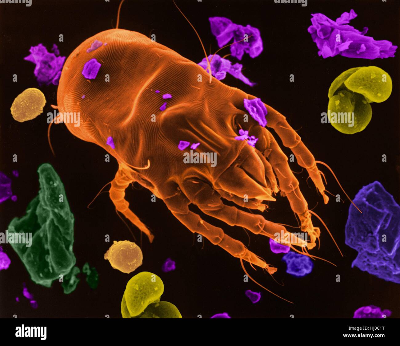 Dust Mite Electron Microscope