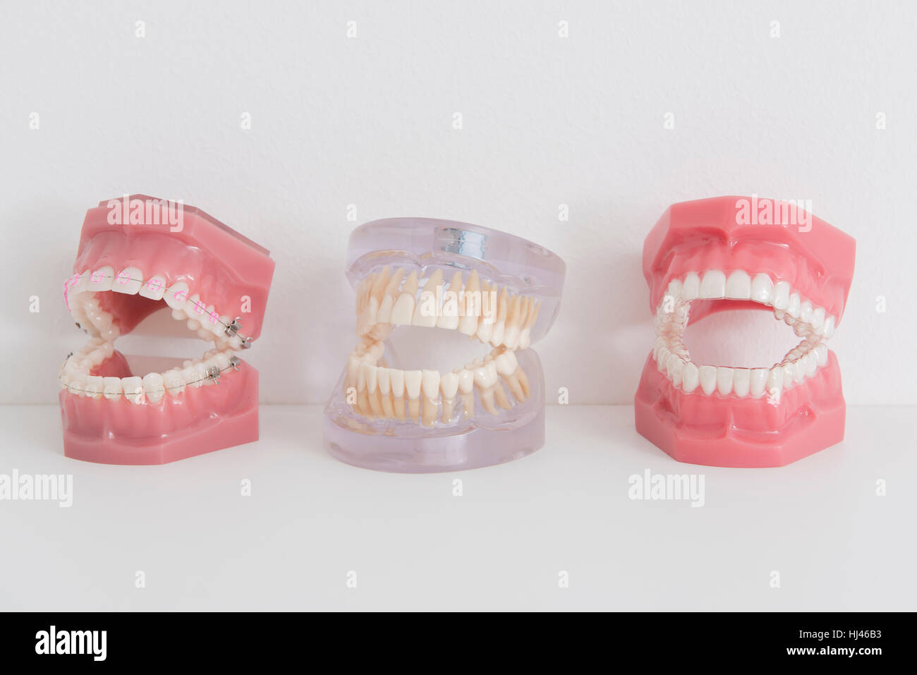 teeth, bit, dentist, pine, tooth, treatment, prosthesis, shine, shines ...