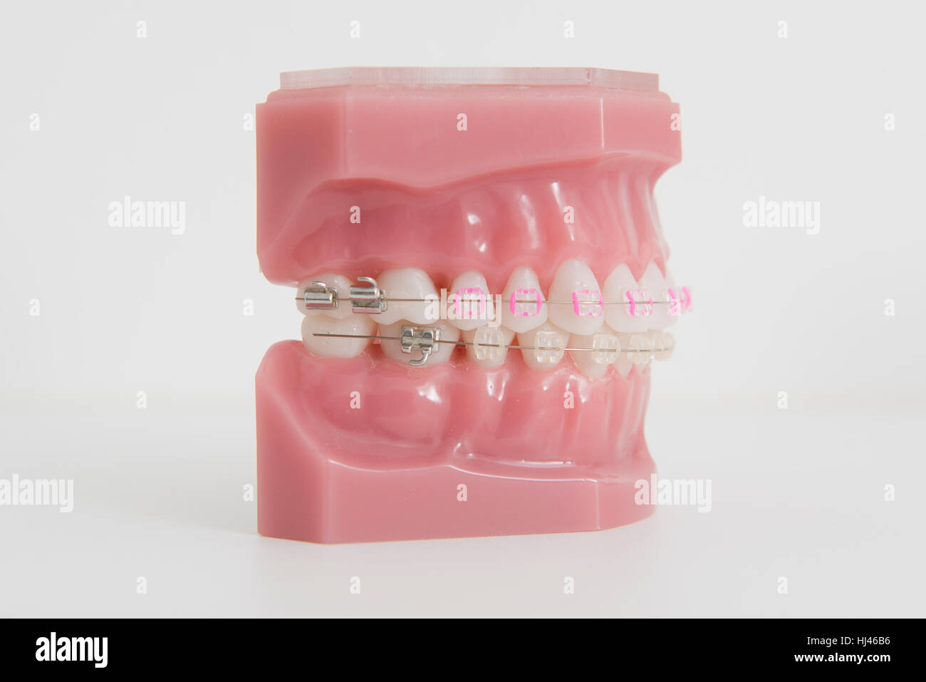 teeth, bit, dentist, pine, tooth, treatment, prosthesis, shine, shines ...