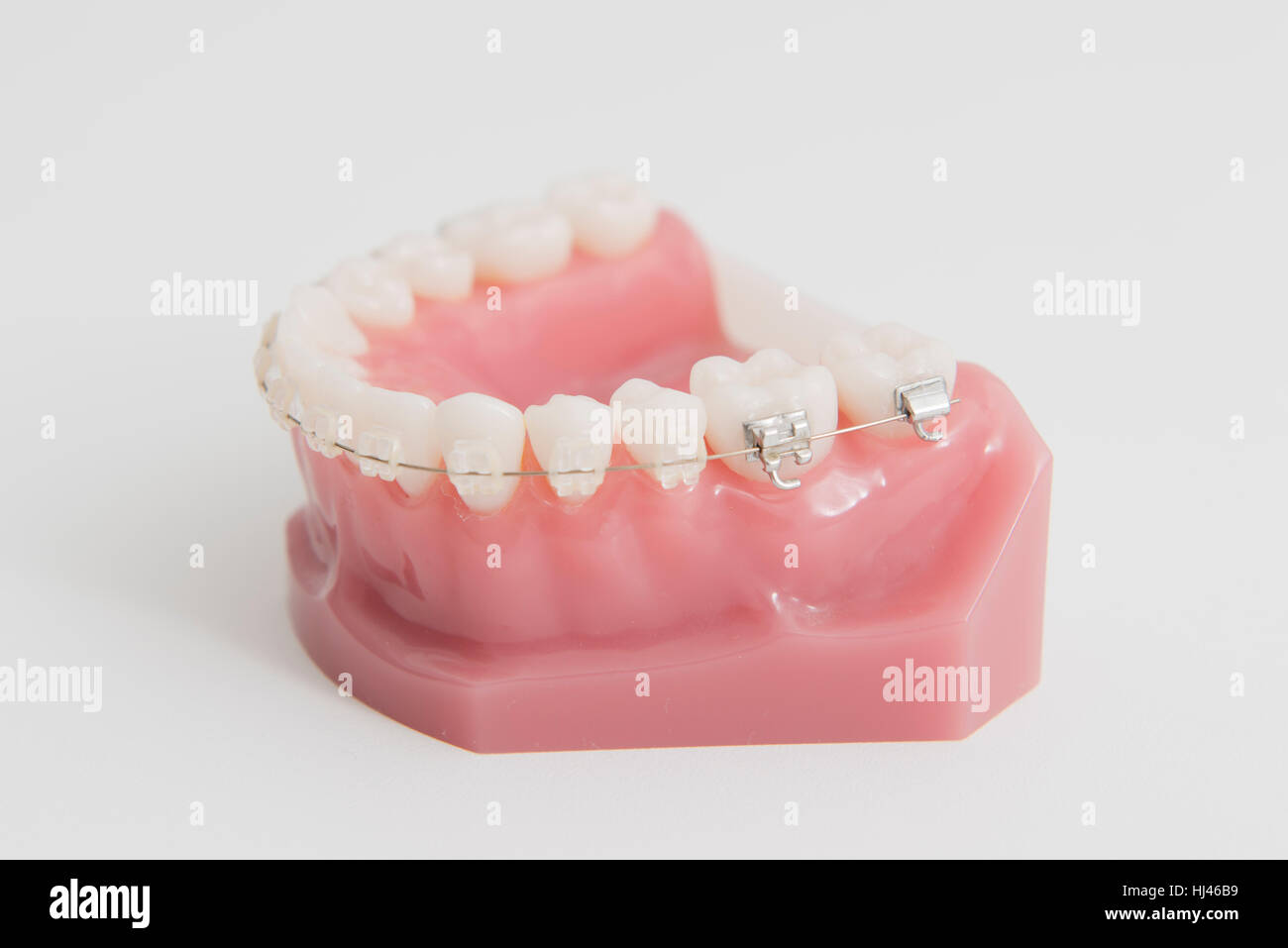 teeth, bit, dentist, pine, tooth, treatment, prosthesis, shine, shines ...