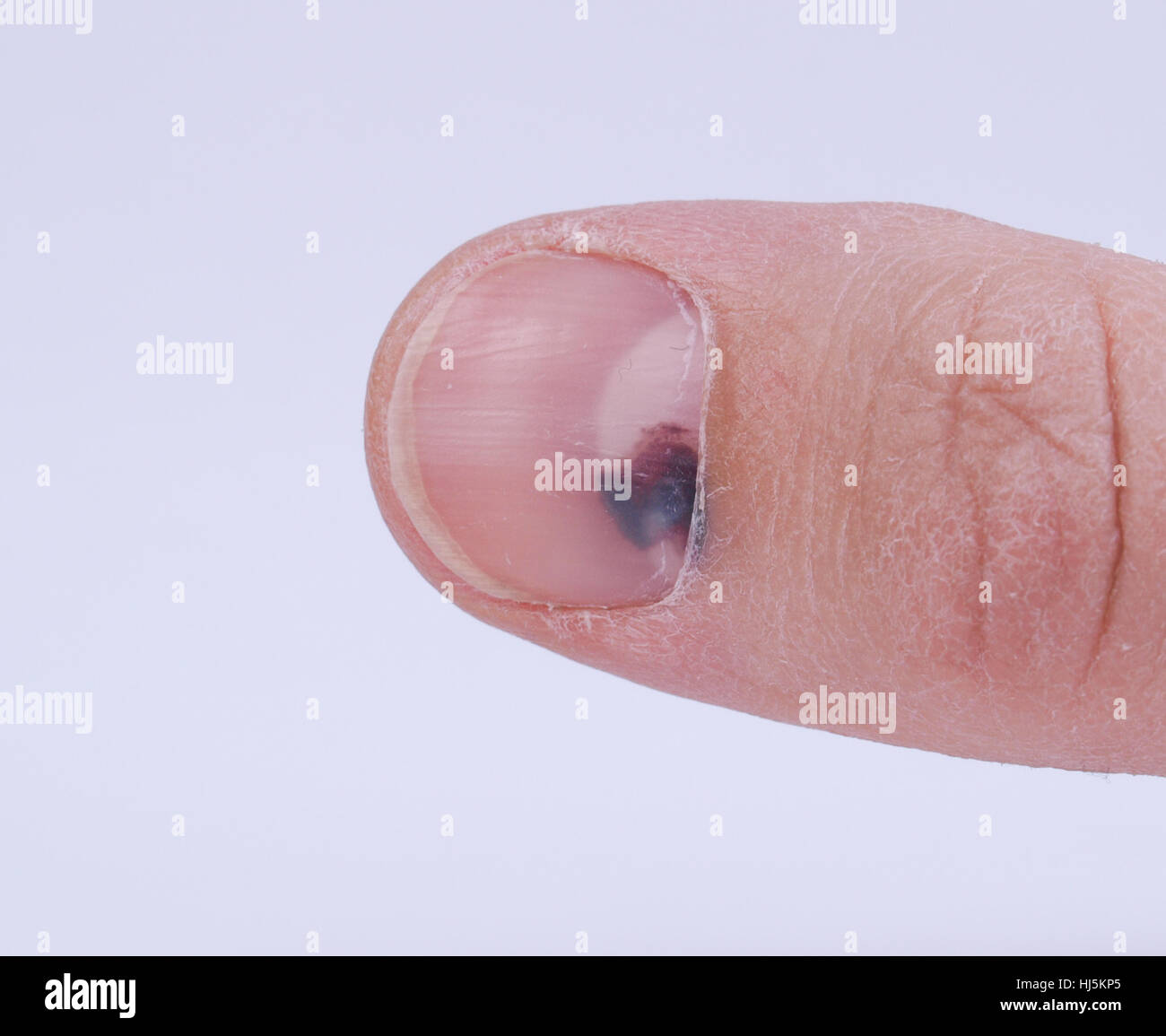 black, swarthy, jetblack, deep black, under, blood, nail, fingernails ...