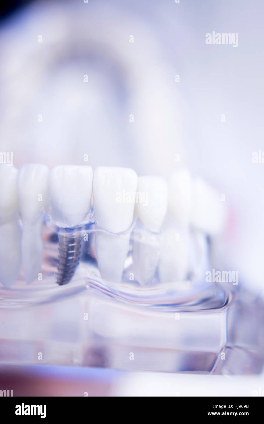 Dentists tooth plastic model used for teaching, learning and patient ...