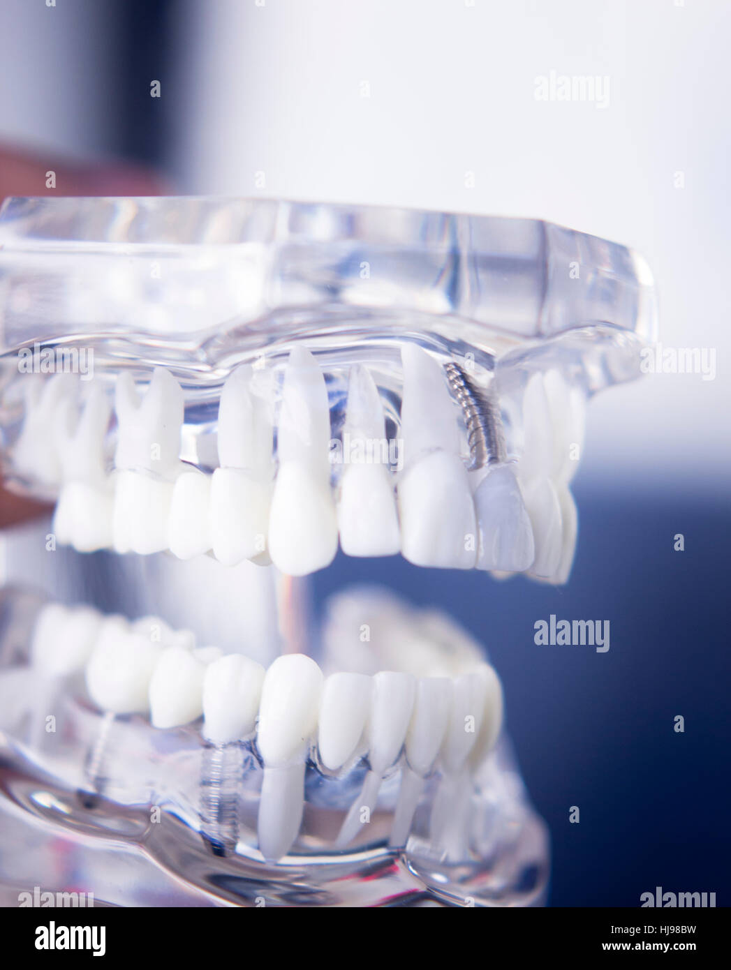 Dentists tooth plastic model used for teaching, learning and patient ...