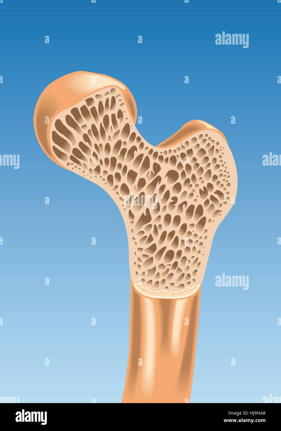 Breaking bone hi-res stock photography and images - Alamy