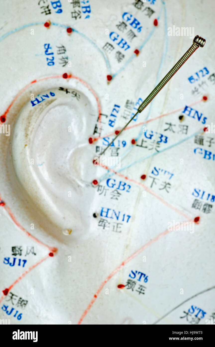 needles, acupuncture, therapy, demonstration, traditional, cure ...