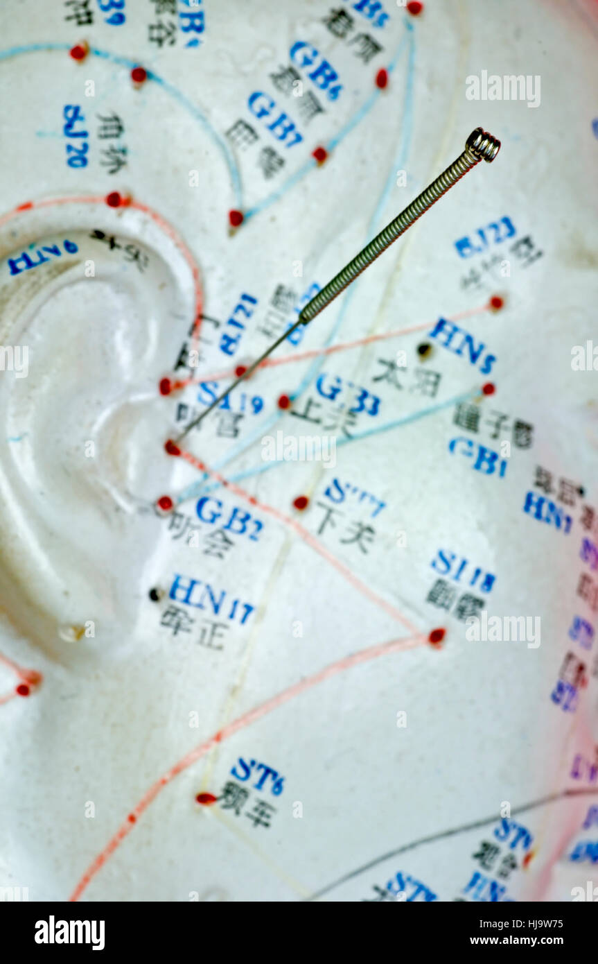 needles, acupuncture, therapy, demonstration, traditional, cure ...