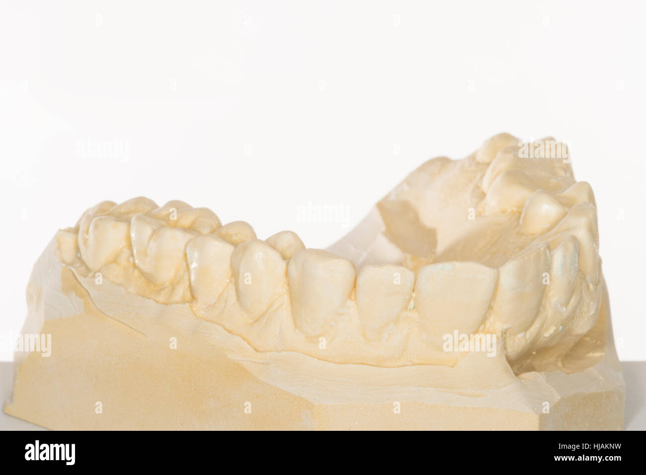 isolated, teeth, bit, tooth, crown, tooth space, caries, dentures ...