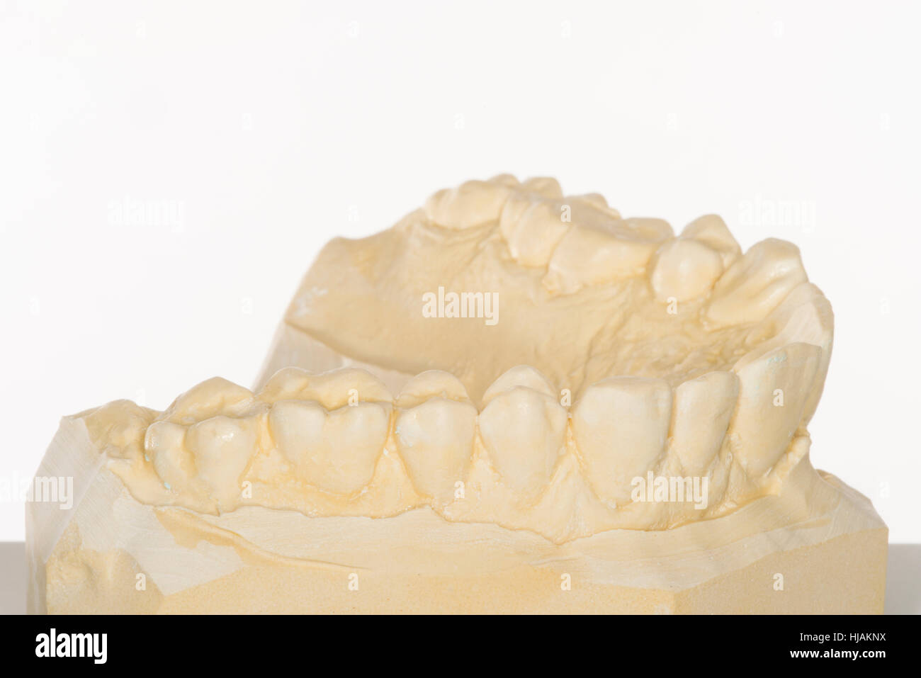 isolated, teeth, bit, tooth, crown, tooth space, caries, dentures ...
