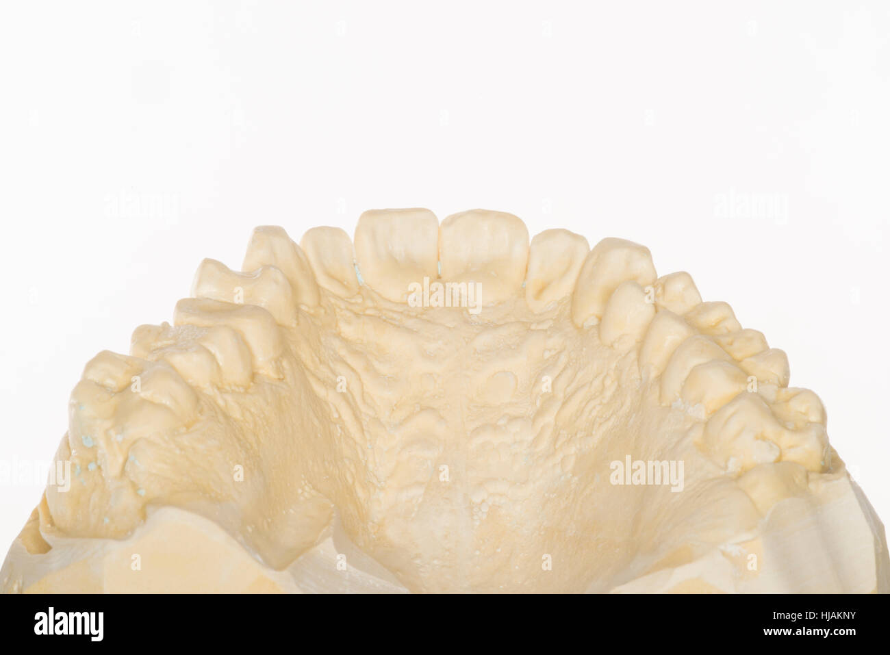 isolated, teeth, bit, tooth, crown, tooth space, caries, dentures ...