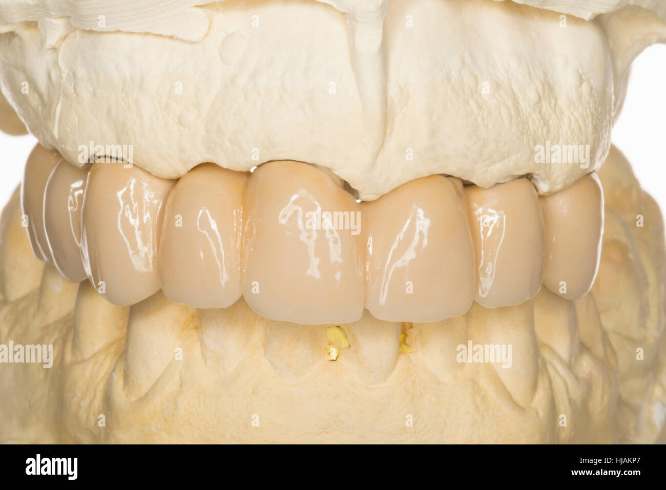 isolated, teeth, bit, tooth, crown, tooth space, caries, dentures ...