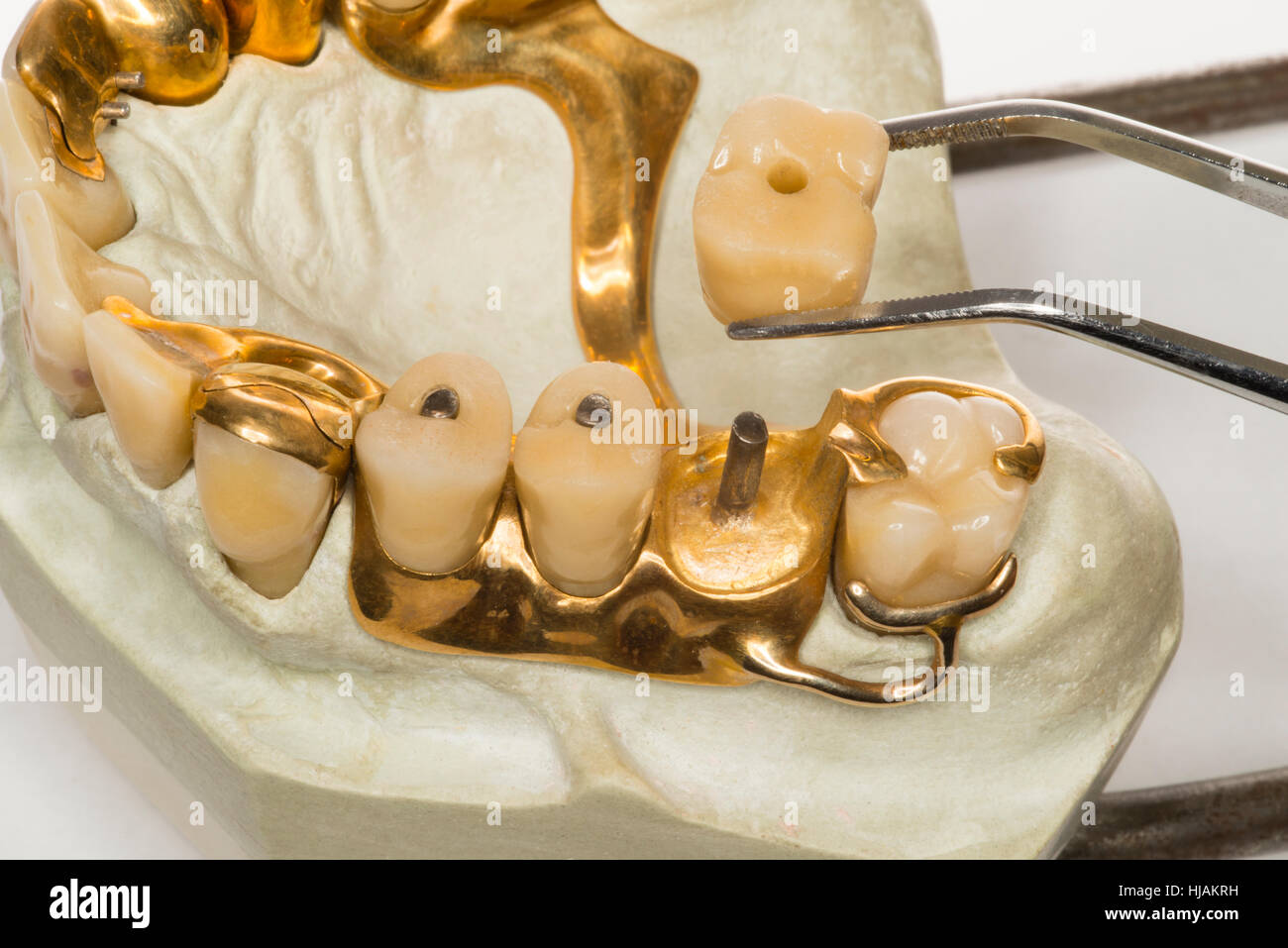 isolated, teeth, dentist, pine, tooth, tooth space, caries, dentures ...