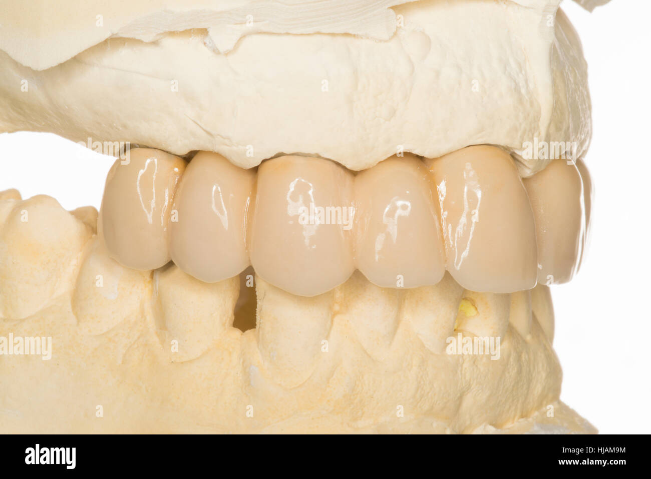 ceramic bridge with antagonist Stock Photo - Alamy