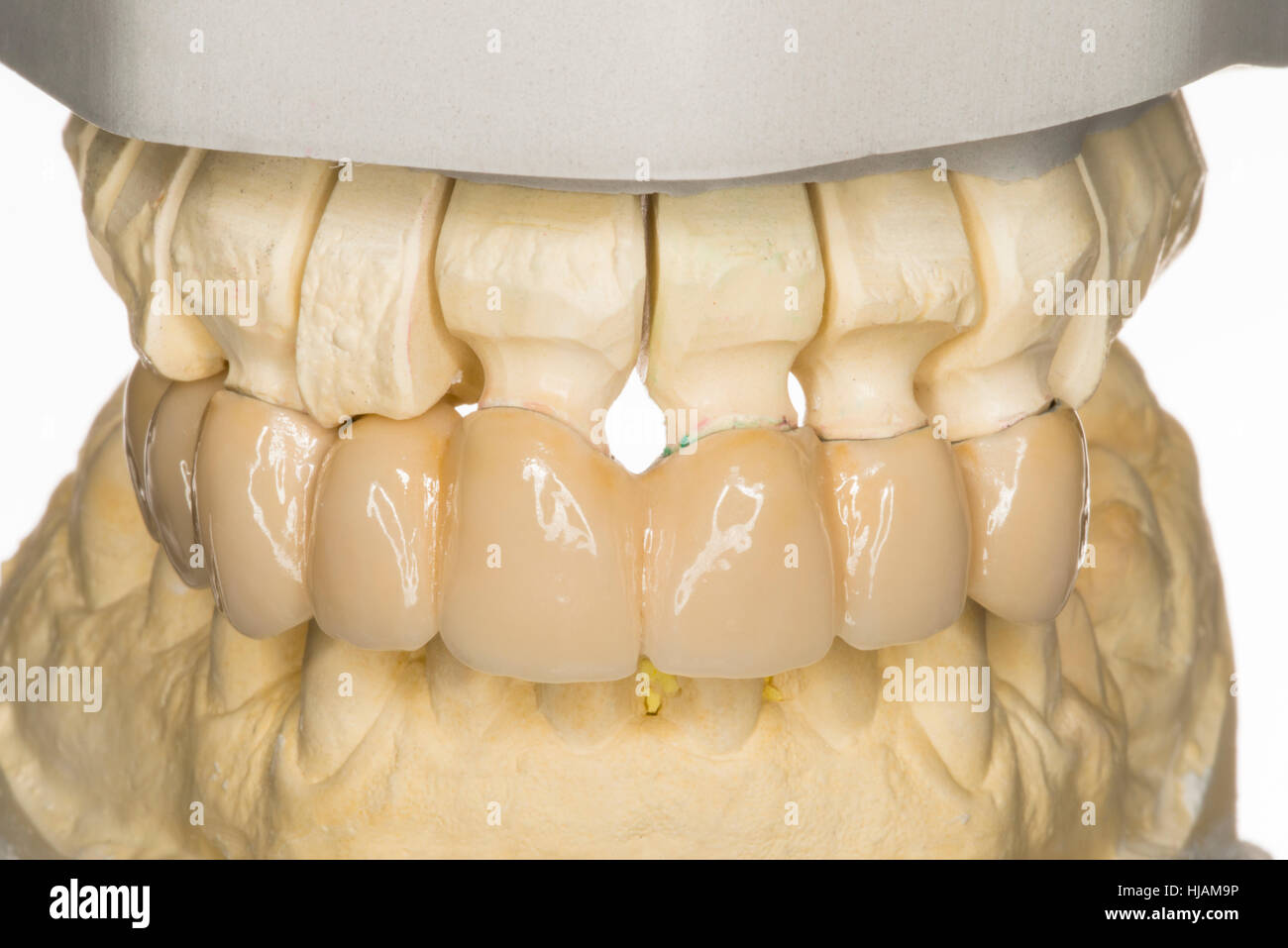 isolated, teeth, bit, tooth, crown, tooth space, caries, dentures ...