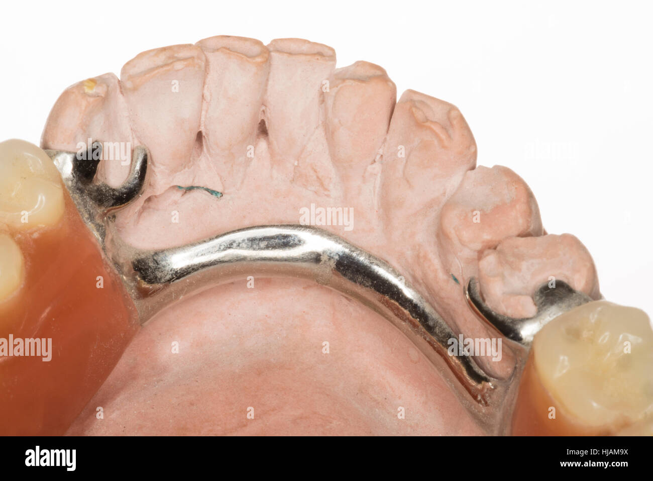 isolated, teeth, bit, dentist, pine, tooth, crown, tooth space, caries ...