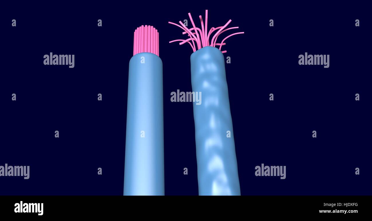 Optic nerve fibers hi-res stock photography and images - Alamy