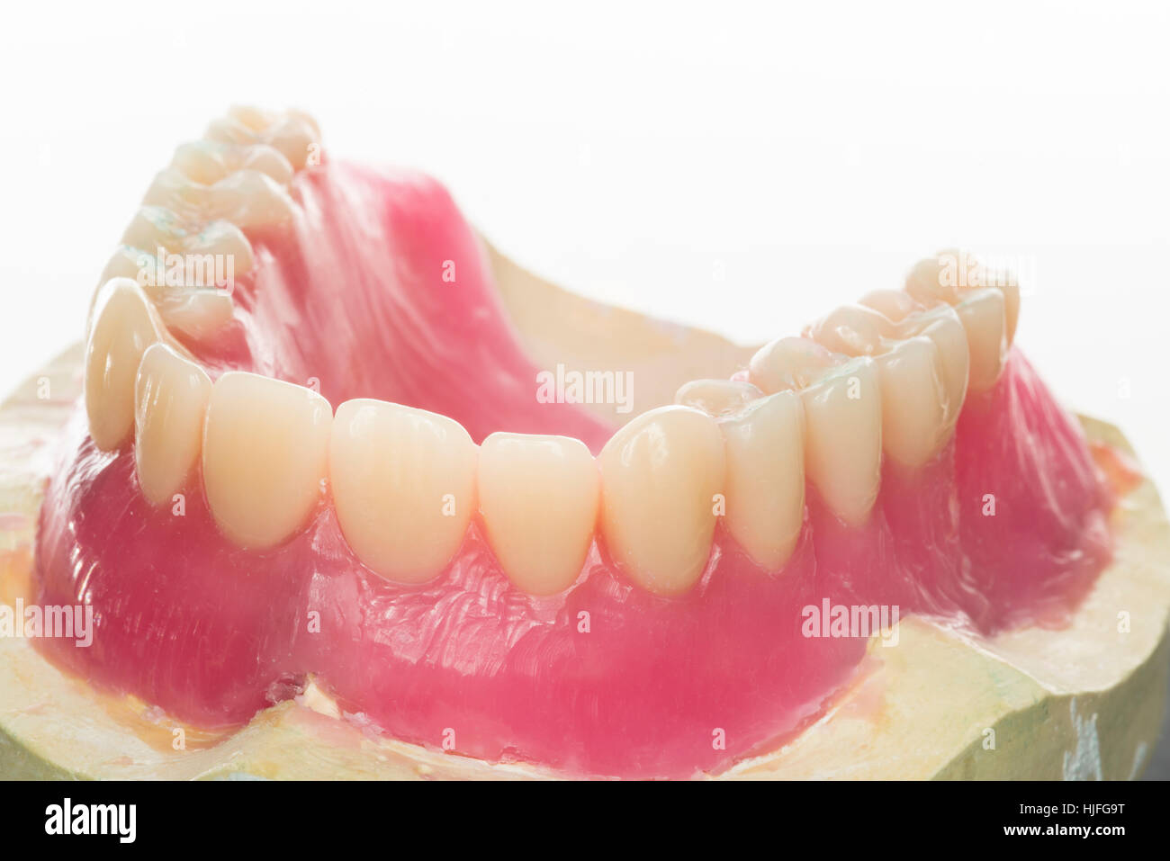 isolated, teeth, bit, dentist, tooth, caries, dentures, mould, dental ...