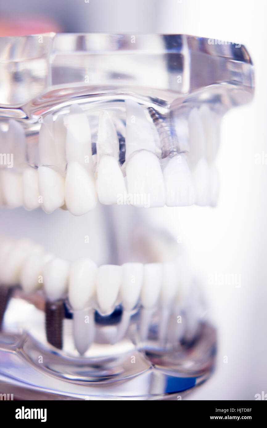 Dentists tooth plastic model used for teaching, learning and patient ...