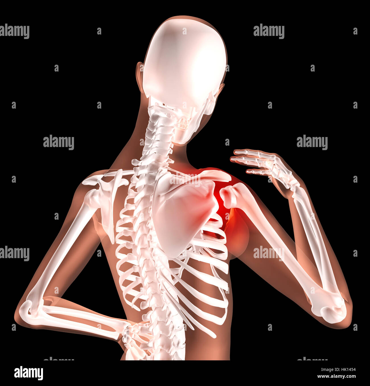 woman-medicinally-medical-female-interior-skin-human-human-being