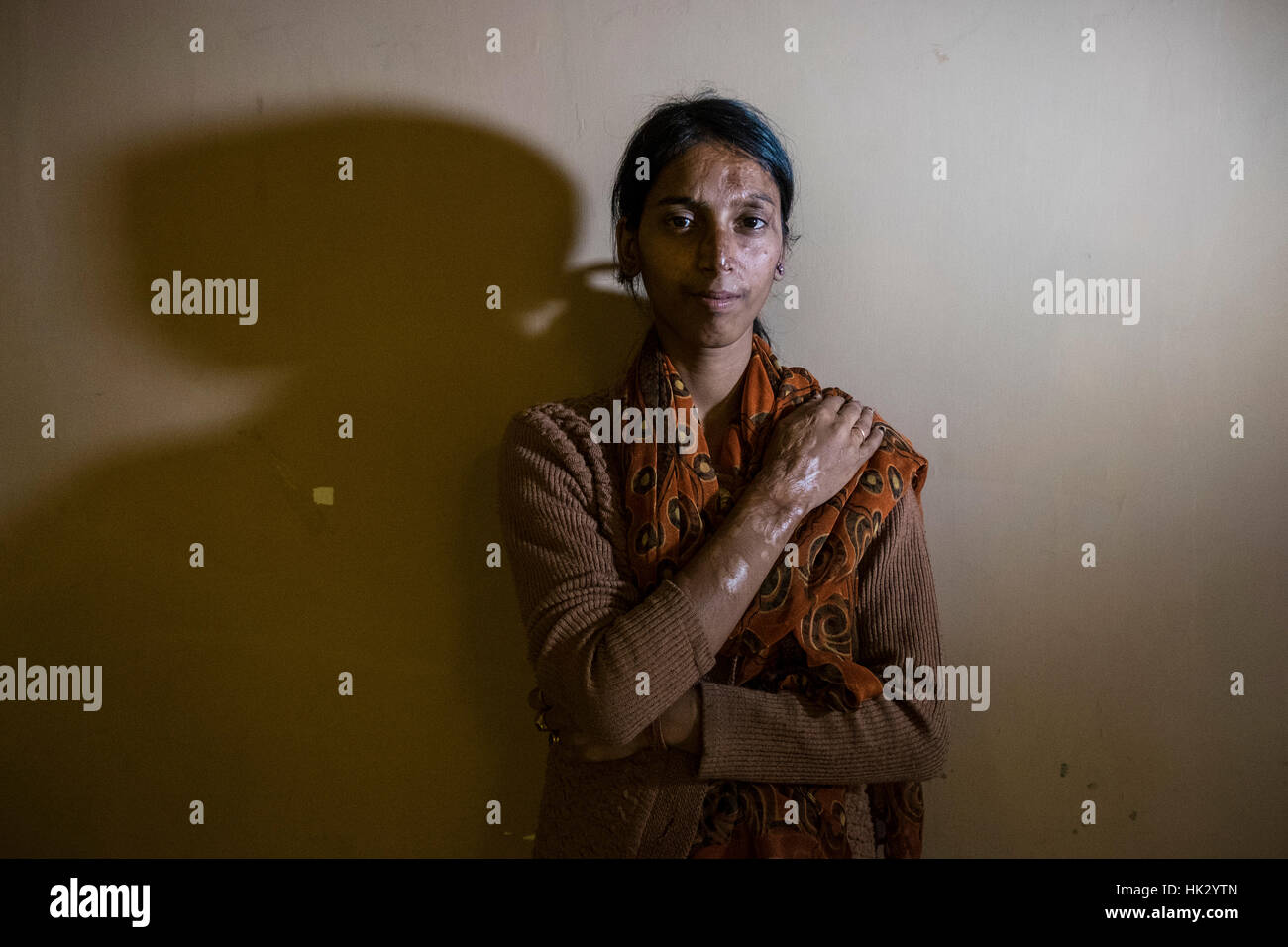 India kolkata women victims acid hi-res stock photography and images ...