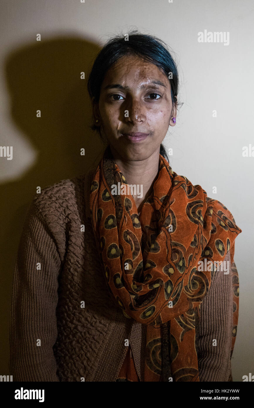 Victims of violence face hi-res stock photography and images - Alamy