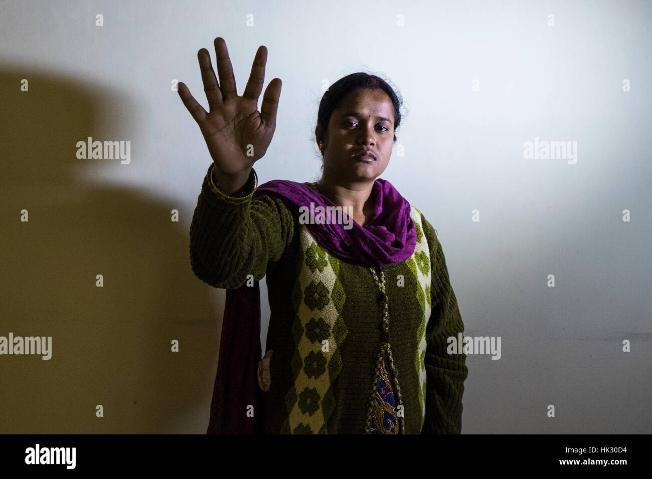 India, Kolkata, Women victims acid attack, portrait Stock Photo - Alamy