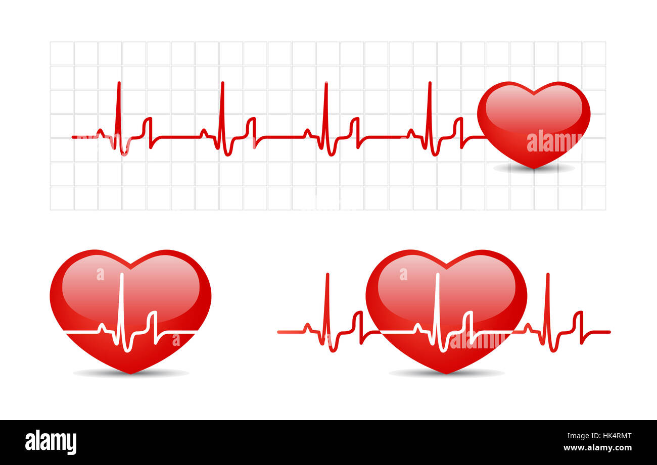 blue, chart, graphic, black, swarthy, jetblack, deep black, monitor ...