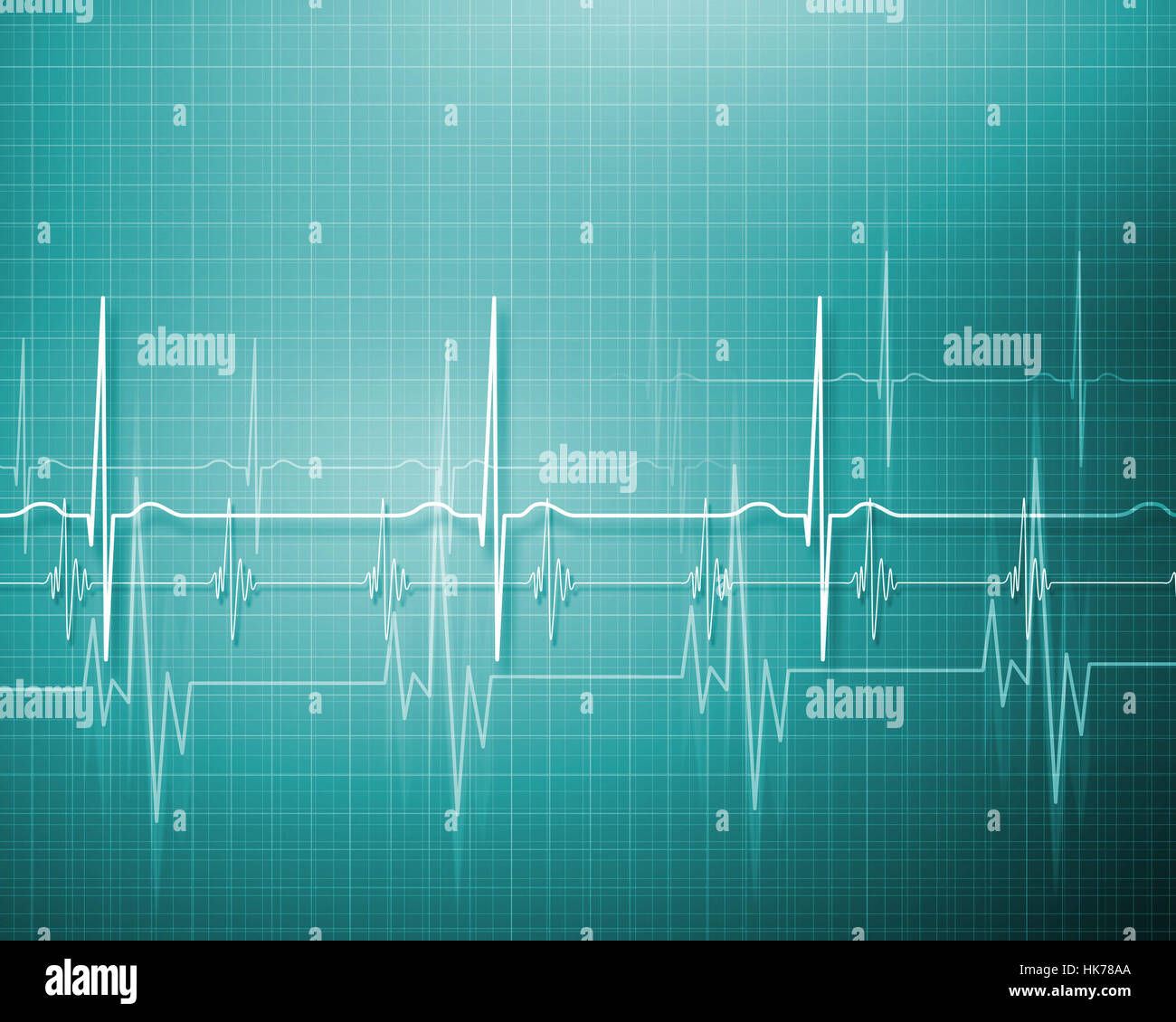 A medical background with a heart beat / pulse with a heart rate ...