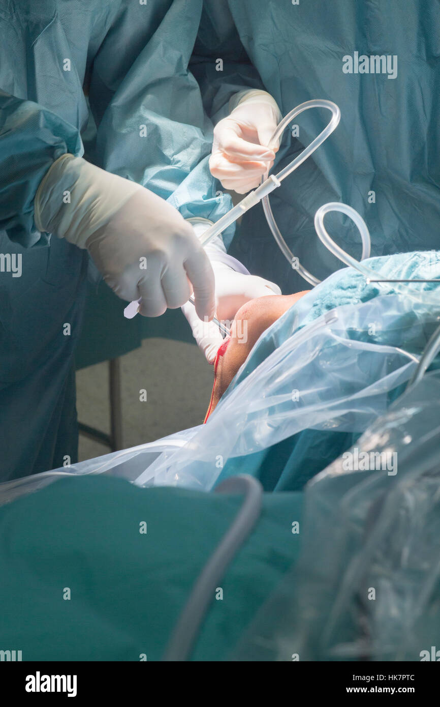 Knee keyhole surgery hospital arthroscopy operation medical procedure ...